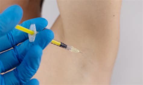 Excessive Sweating Mens Care Clinic