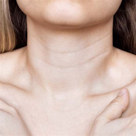 Neck Lines Sydney Botox And Anti Wrinkle Injection Experts