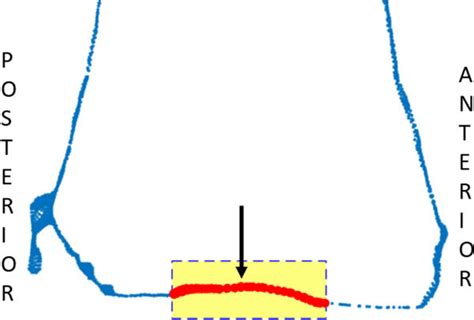 Cross Section Of The Isolated Distal Tibia In Sagittal View The Download Scientific Diagram