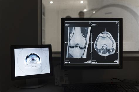 Digital X Ray In Indore Ultrascan Diagnostics