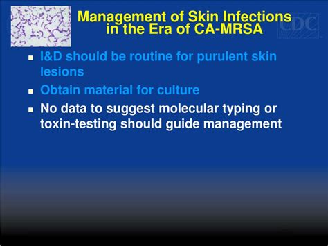 Ppt Mrsa Epidemiology And Treatment Powerpoint Presentation Free Download Id 4493346