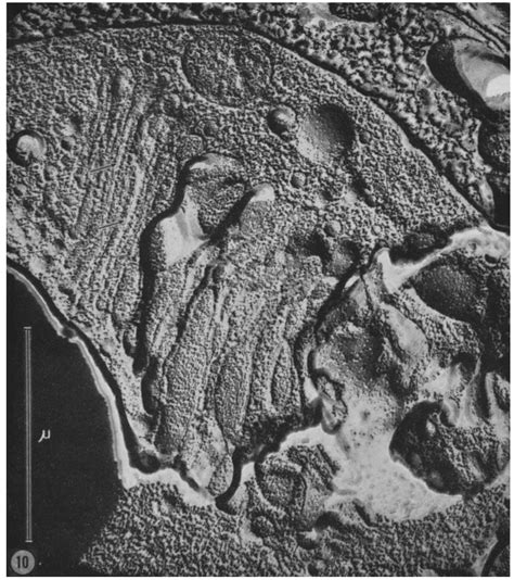 Fracture Plane Across A Stack Of Cisternae Revealing The Polarity Of Download Scientific