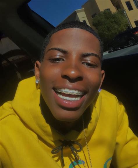 Braces Colors For Dark Skin