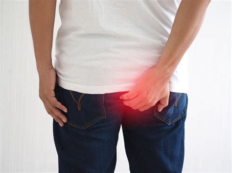 External Hemorrhoid With Rash
