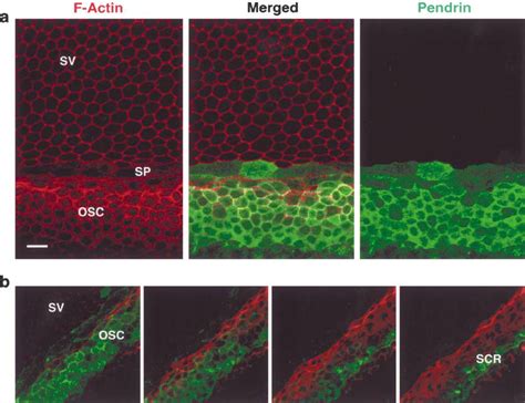 Immunolocalization Of Pendrin In The Mouse Cochlea Whole Mount Cochlea