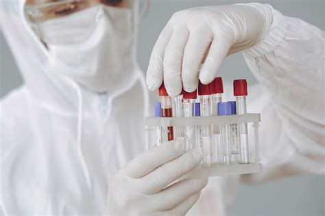 Test Sierologici COVID 19 Biomolecular Diagnostic