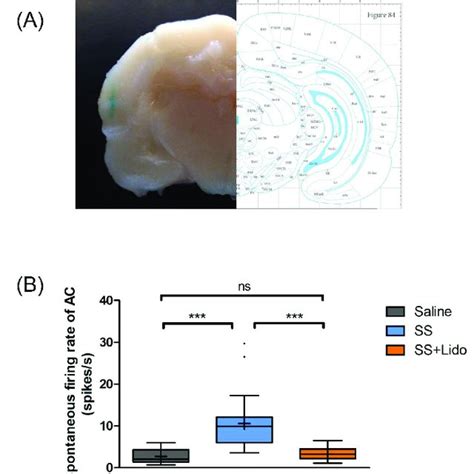 Effects Of Ss And Lidocaine On Neural Activity In The Ac A Download Scientific Diagram