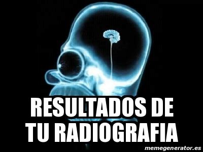 Meme Personalizado RESULTADOS DE TU RADIOGRAFIA 30819939