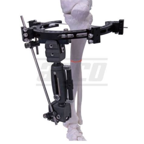 Deformity Correction External Fixator Ring Fixator Assembly For Reconstruction ASCO Medical