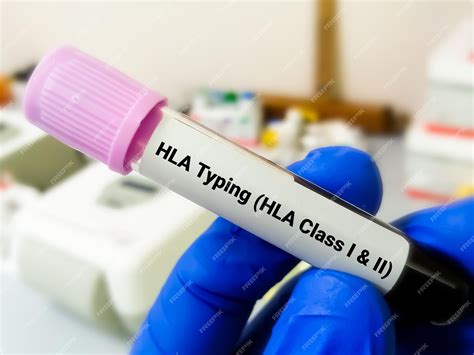 Premium Photo Biologist Holding Blood Sample For Hla Typing Class 1 And 2 Testing Pcr Laboratory