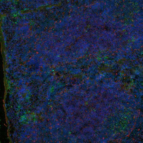 Mouse Tslp Antibody Mab555 100 Randd Systems