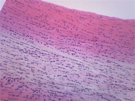 Fibrocartilage Connective Tissue