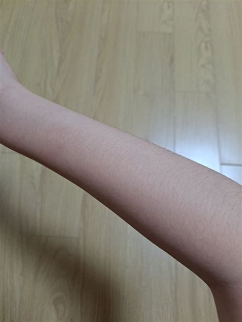 여자 팔 털 지식in