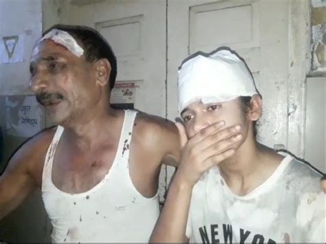 Nephews Entered Uncles House And Fired Father And Daughter Injured