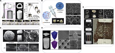 Scaffolds For Bone Tissue Engineering Matter