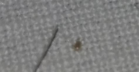 This Bug Zoomed And Cropped Pics Album On Imgur