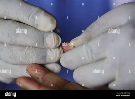 Health Workers Are Testing Blood Of Drivers From Different Commercial