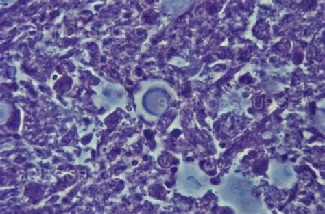 Lm Of Cryptococcus Neoformans Stock Image Science Source Images