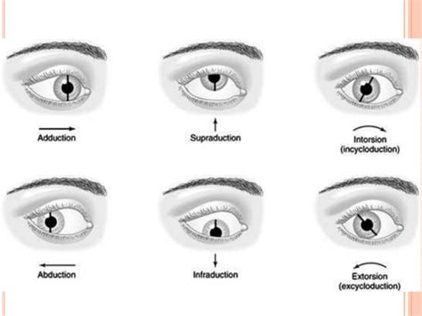 Diplopia Approach