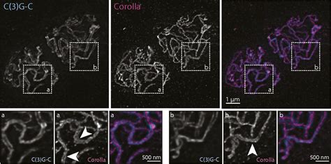 Superresolution Expansion Microscopy Reveals The Three Dimensional