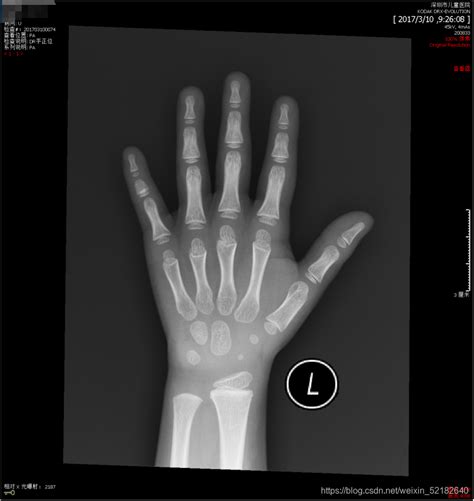 Python Opencv 多边形拟合python Approxpolydp Csdn博客