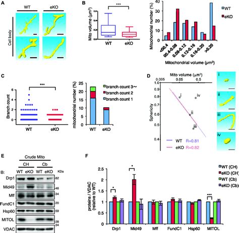 sbf sem analysis unveiled loss of large and branched mitochondria in