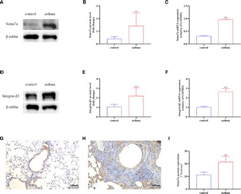 Semaphorin 7a Aggravates Tgf β1 Induced Airway Emt Through The Fakerk1