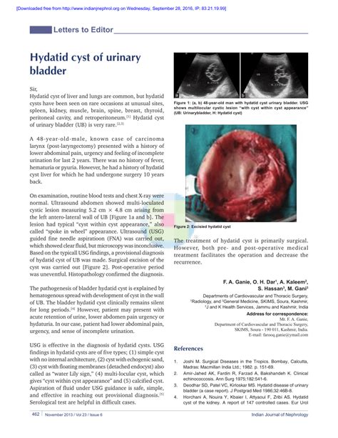Pdf Hydatid Cyst Of Urinary Bladder
