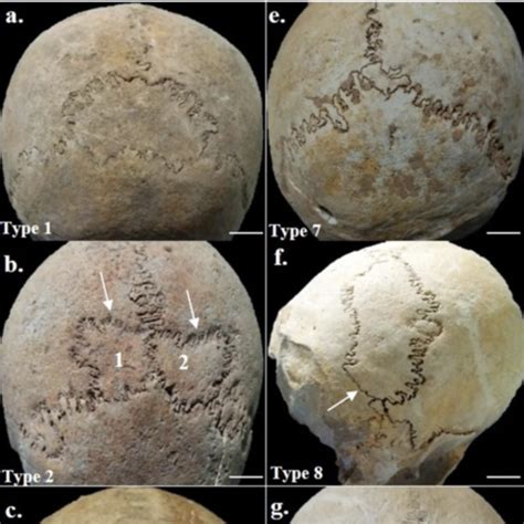 Bone And Axial Skeleton Flashcards Quizlet