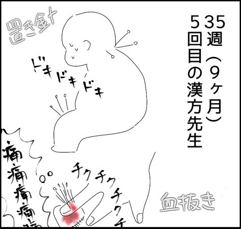 妊娠後の皮膚トラブル30 ついに らっちょんブログ 育児と酒さ様皮膚炎と猫