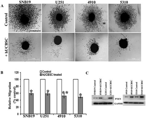 Conditioned Medium From Co Culture Of Glioma Cells With Hucbsc Inhibits