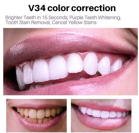 Whitening Toothpaste Teeth Whitening Toothpaste Latest Price