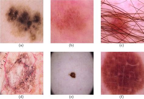 Six Examples Of The Challenges A Fuzzy Border B Low Contrast