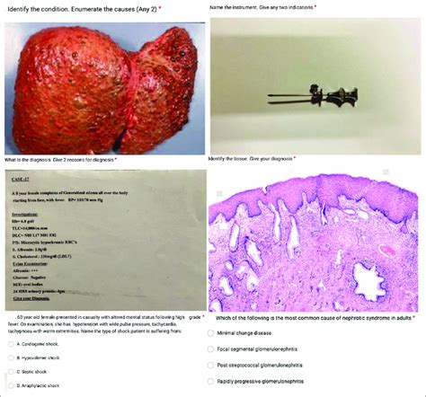 Various Question Formats Included In The Hybrid Assessment Model Gross