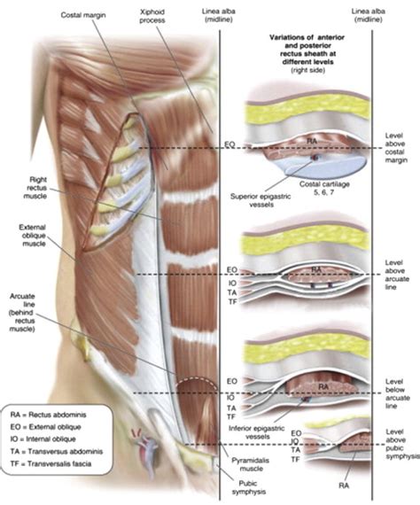 Open Ventral Hernia Repair With Component Separation Surgical Clinics
