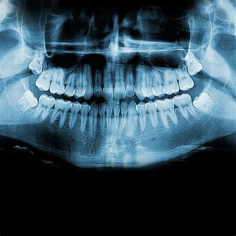 Structural Morphology Student Academic Success