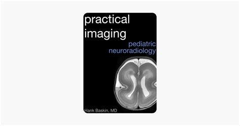Practical Imaging Pediatric Neuroradiology On Apple Books