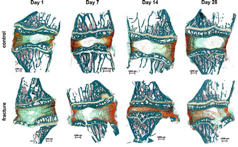 Photomicrographs Of Massongoldner Trichrome Stained Sagittal Tissue
