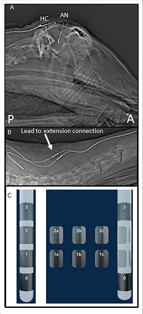 Figure 1 From Long Term Performance Of A Bi Directional Neural