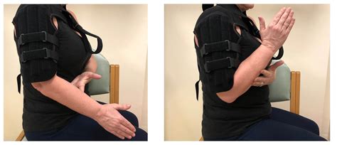 Humeral Fracture