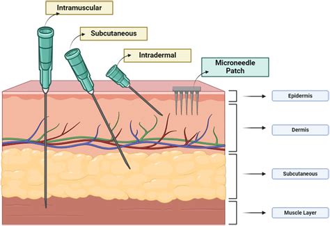 Enhancing Vaccine Accessibility And Efficacy Through Microneedle