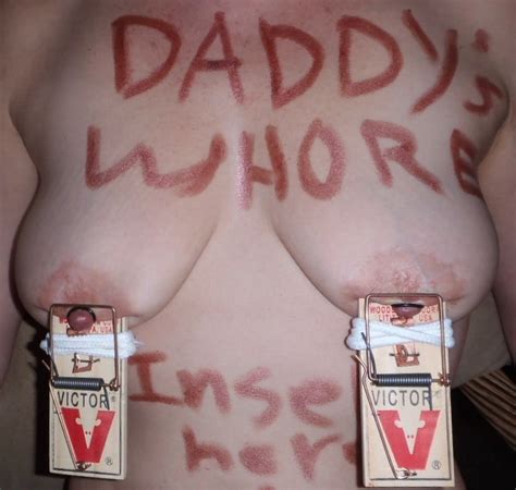 Bdsm Tits Porn Pictures Xxx Photos Sex Images 3977690 Pictoa