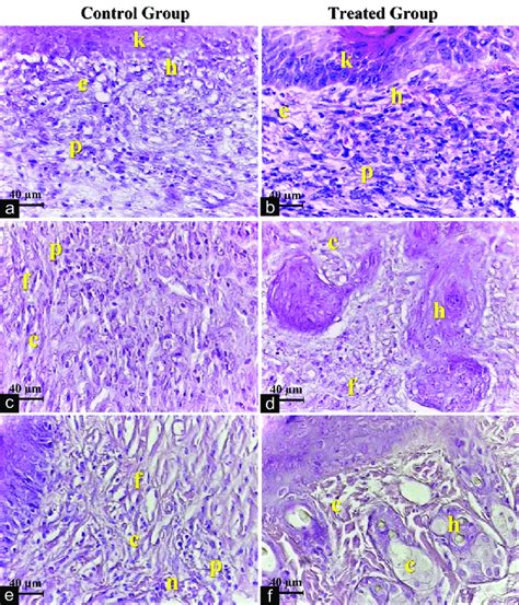 A Control Group 7 Days Large Numbers Of Polymorphonuclear Cells P