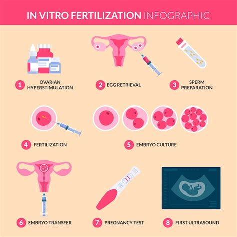 Free Vector Hand Drawn Flat Design Ivf Infographic