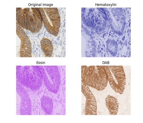 neurohackademy 2018 image processing with scikit image