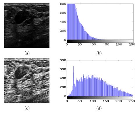 Image Histogram Equalization A An Example Of Original Image B Download Scientific Diagram