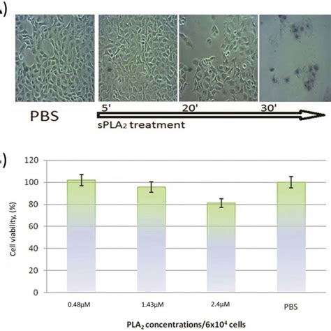 Fluorescence Micrographs Of Mdck Ii A And Rpe 1 B Cells After