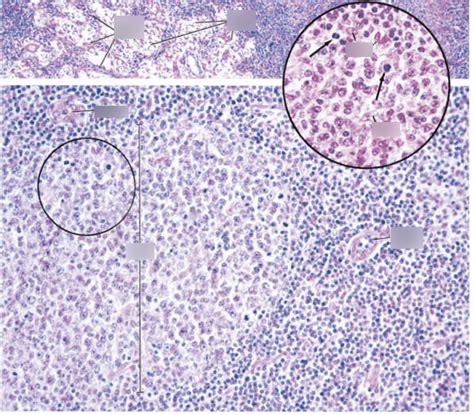 Lymphatic Nodule Key Terms And Definitions Flashcards Quizlet Lymphatic Nodule Key Terms And Definitions Flashcards Quizlet