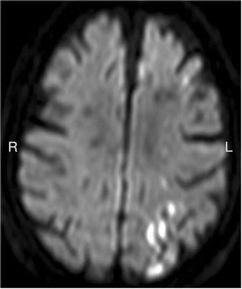 Cerebrum Clinical Tree