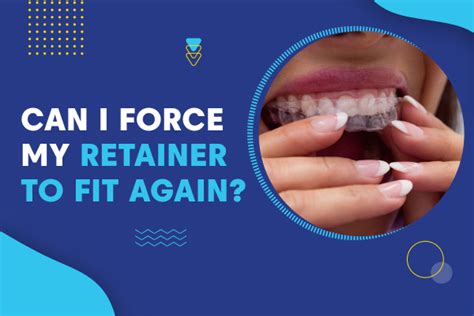 What To Do If My Retainer Doesnt Fit Anymore A Guide